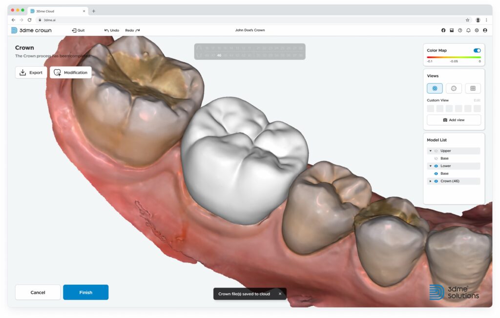 Imagoworks launches AI-based web dental CAD 3Dme Crown - KoreaTechDesk ...